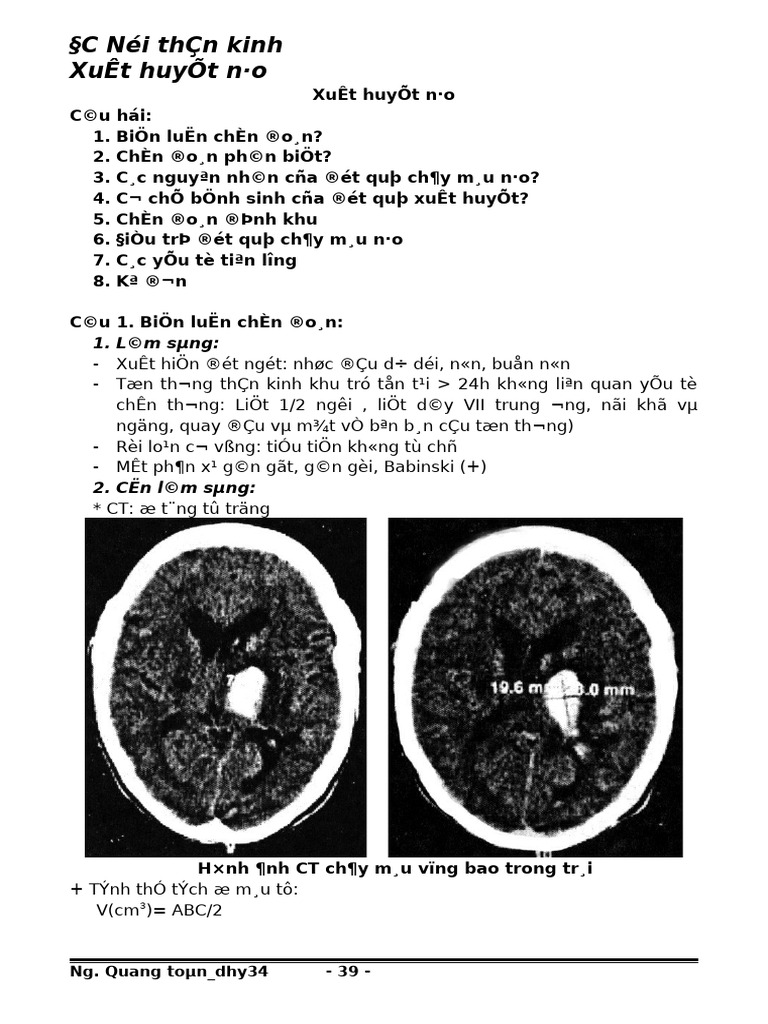 02-Xuat Huyet Nao | PDF