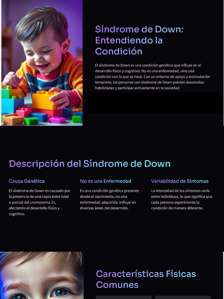 sindrome de down pdf | PDF