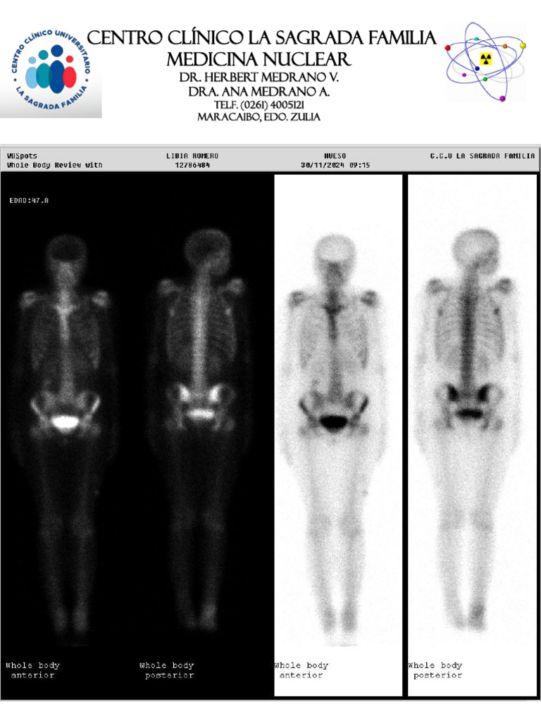 Centellograma en Medicina Nuclear | PDF