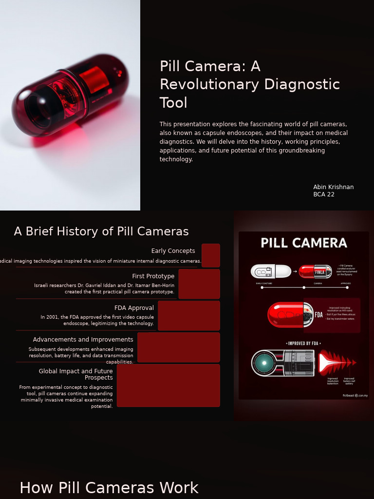 Pill Camera: Innovations in GI Diagnostics | PDF | Clinical Medicine ...