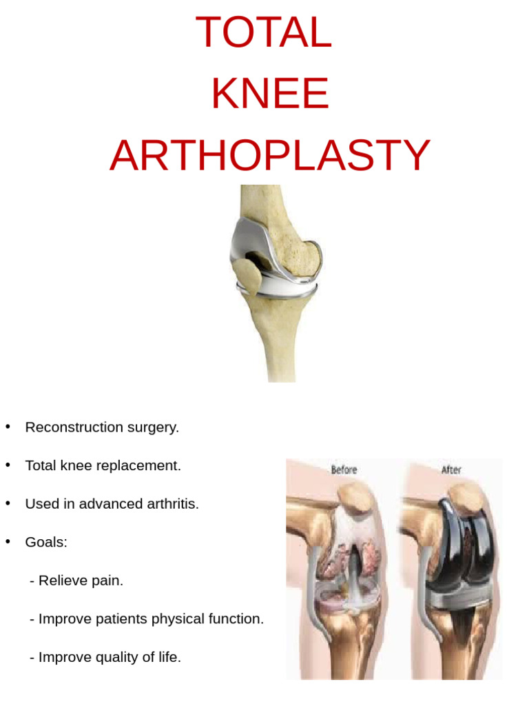 Total knee replacement | PDF | Knee | Musculoskeletal System