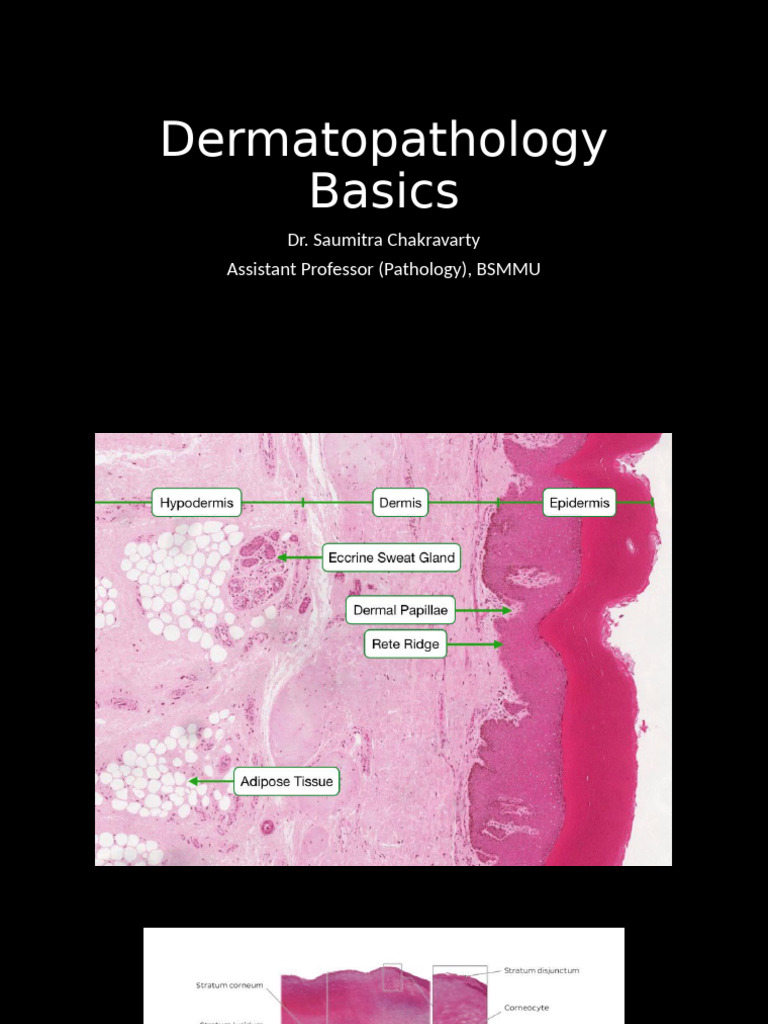Dermatopathology Basics Explained | PDF