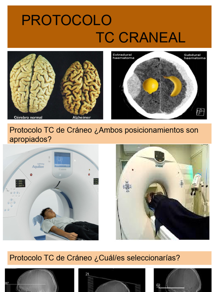 Protocolo y Casos Clínicos de TC Craneal | PDF | Cráneo | Enfermedades ...