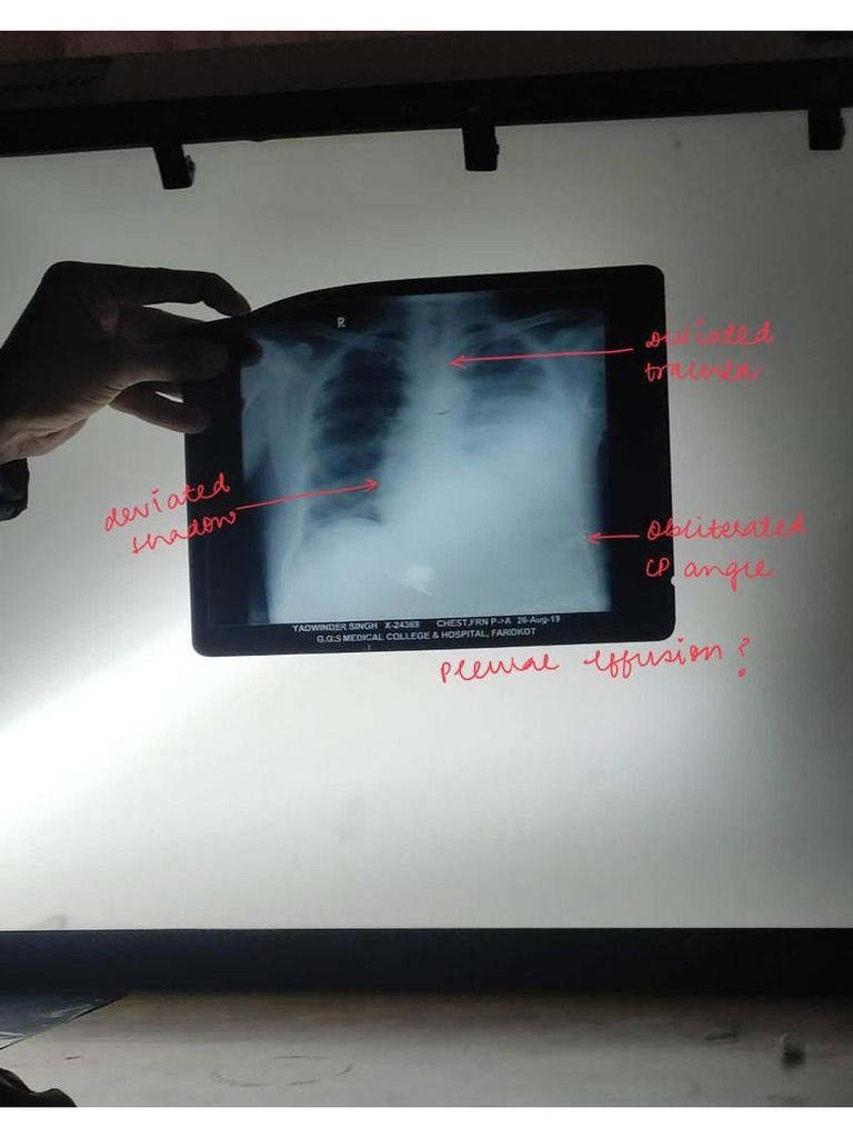 Surgery Xray Labelled | PDF