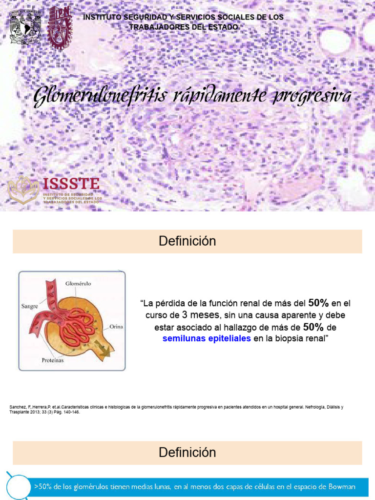 Glomerulonefritis Rápida: Definición y Tratamiento | PDF | Nefrología | Medicina