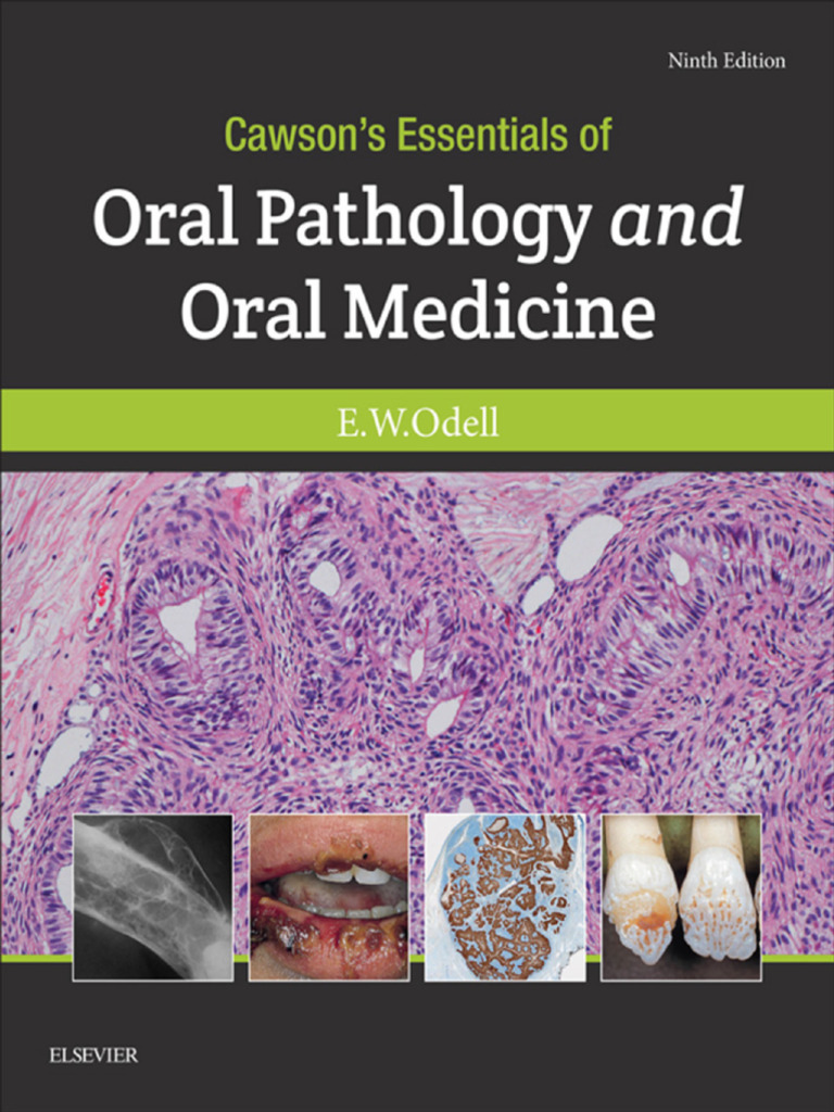 Cawson's Essentials of Oral Pathology and Oral Medicine. 9th Edition-1 | PDF