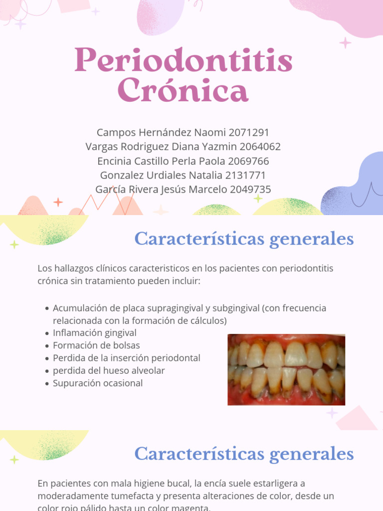 Características de la Periodontitis Crónica | PDF | Enfermedades y ...