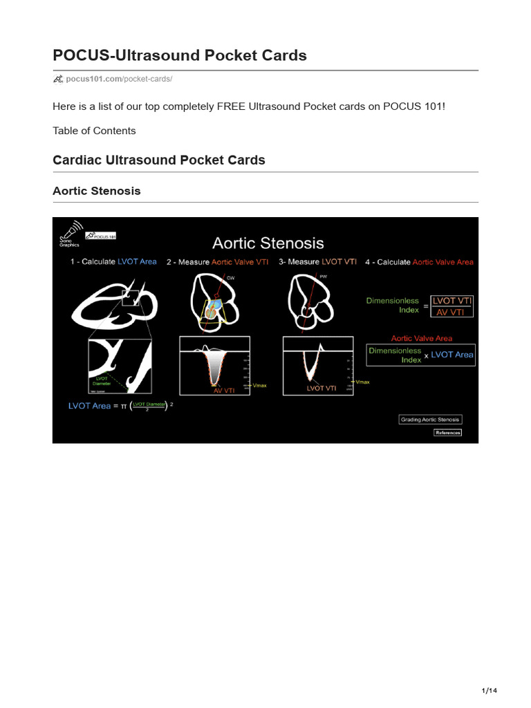 POCUS Ultrasound Pocket Cards | PDF