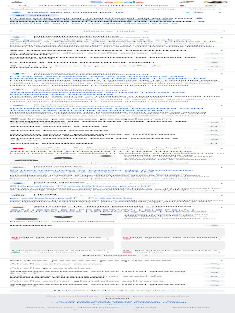 Atrofia Acinar Multifocal Biopsia Prostata - Pesquisa Google | PDF | Câncer de próstata | Próstata