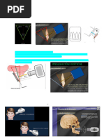 Técnica Mento-Naso-Placa en Radiología | PDF | Cabeza y cuello humanos ...