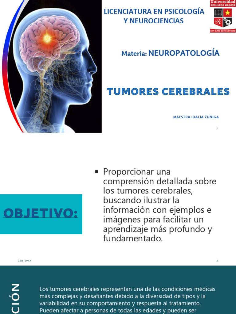 Tema 3 Tumores Cerebrales | PDF | Tumor cerebral | Cáncer