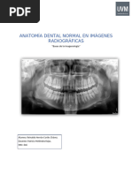 Anatomía de La Arcada Superior e Inferior de Un Paciente Edéntulo | PDF | Anatomía humana | Anatomía