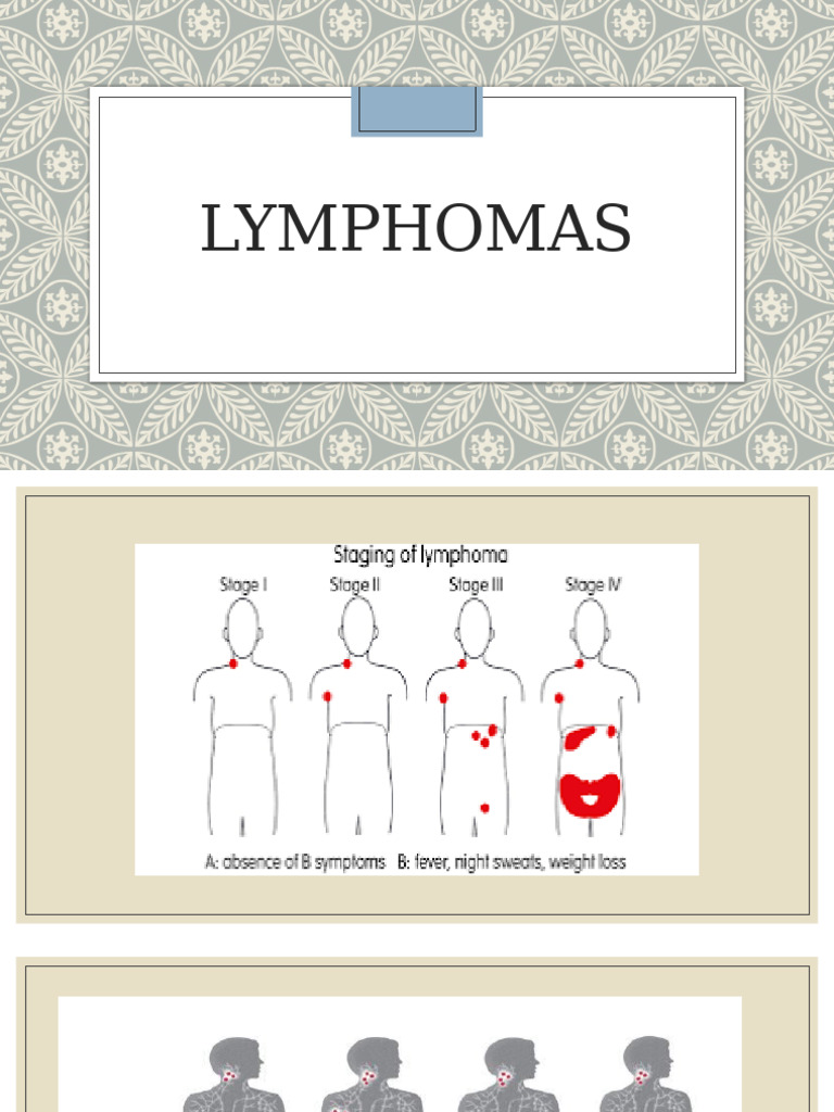 LYMPHOMAS | PDF