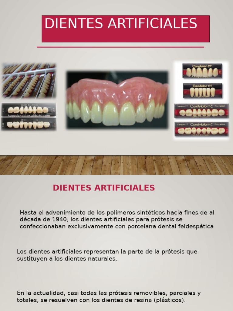 Dientes Artificiales | PDF | Materiales