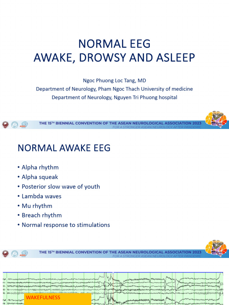 Normal Awake and Sleep Eeg - Loc Tang | PDF | Electroencephalography ...