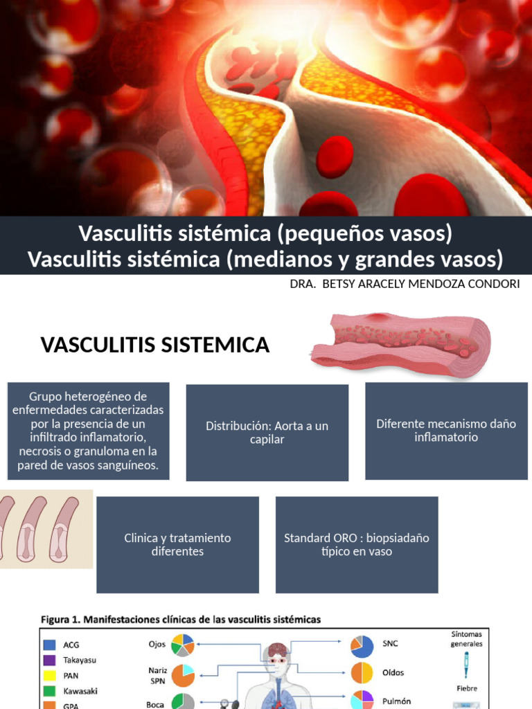 VASCULITIS - PPTX MODICADO 2025 | PDF | Enfermedades y trastornos | Medicina CLINICA
