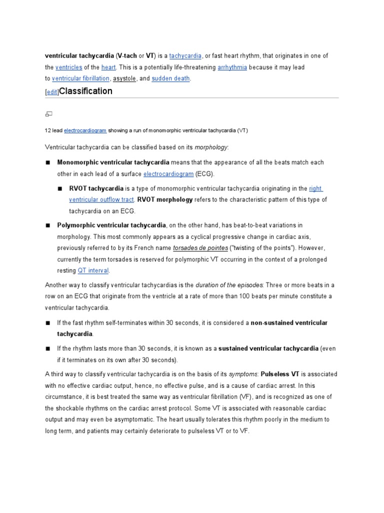 Classification: Tachycardia Ventricles Heart Arrhythmia Ventricular ...