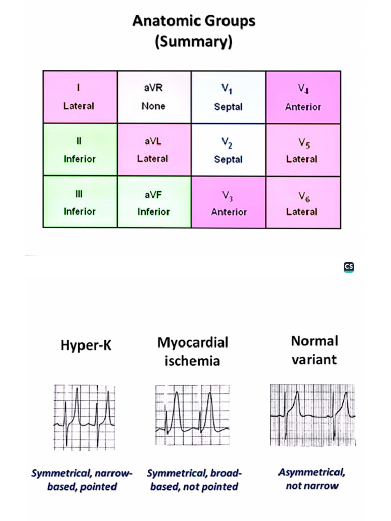 Ecg 1 DR Hossam | PDF