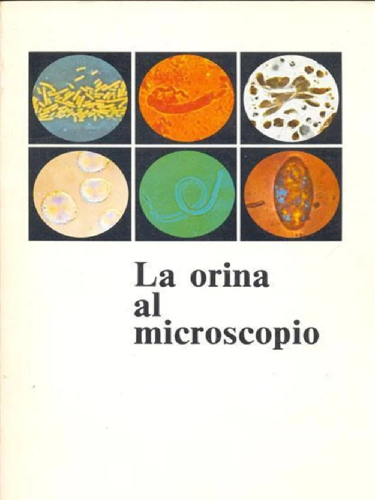 Examen Microscopico de La Orina. Dr. Maick | PDF