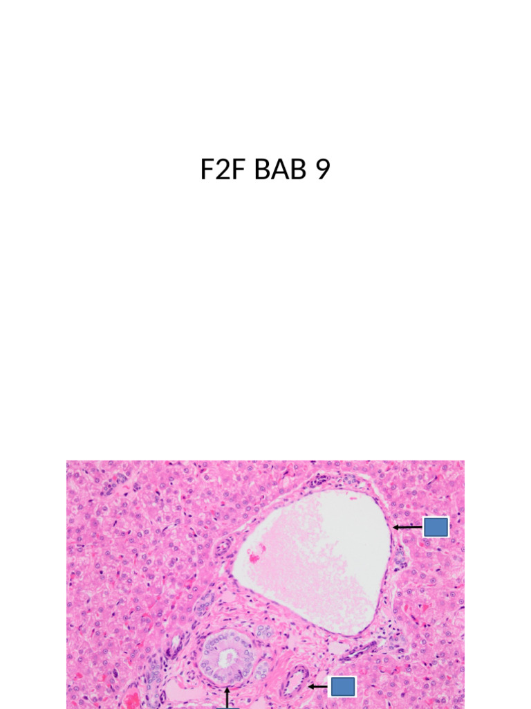 F2F Bab 9 | PDF