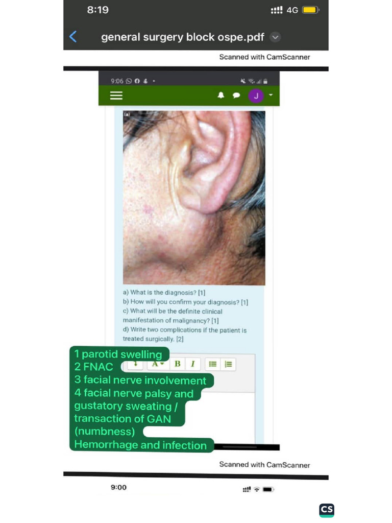 Ospe PP Surgery Solved | PDF