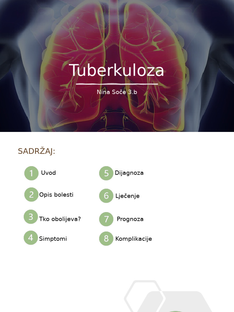 Tuberkuloza Prezentacija | PDF