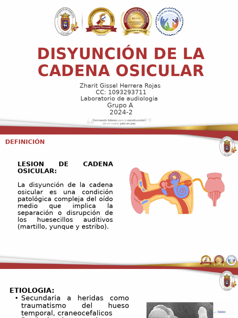 Disyunción de La Cadena Osicular 2 | PDF | Oído | Escuchando