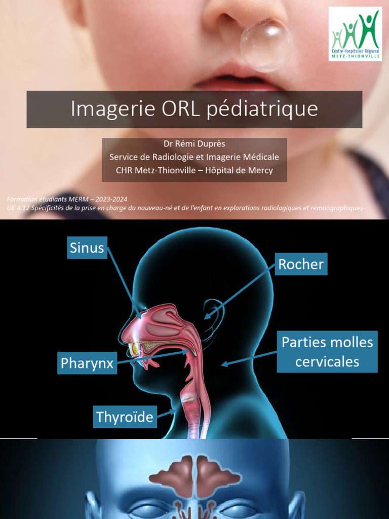 Phlegmon Amygdalien en Imagerie ORL | PDF | Spécialités médicales ...