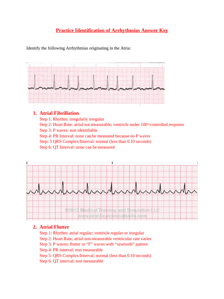 Answer Key Arrhythmias Identification | PDF | Atrium (Heart) | Cardiac ...