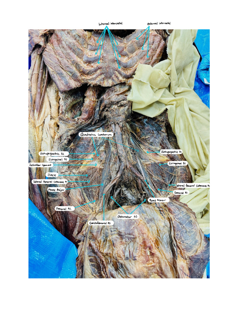 Spinal 2 Lab Final Review Images | PDF | Thorax (Human Anatomy) | Soft ...