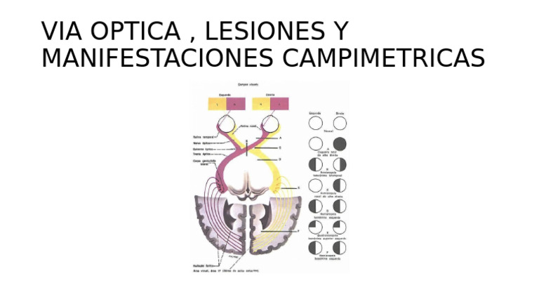 Via Optica, Lesiones y Manifestaciones Campimetricas | PDF