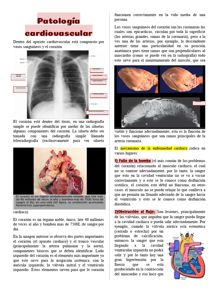 PATOLOGÍA CORAZÓN II | PDF | Corazón | Insuficiencia cardíaca
