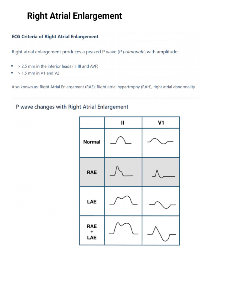 Atrial Enlargement 250324 191710 | PDF