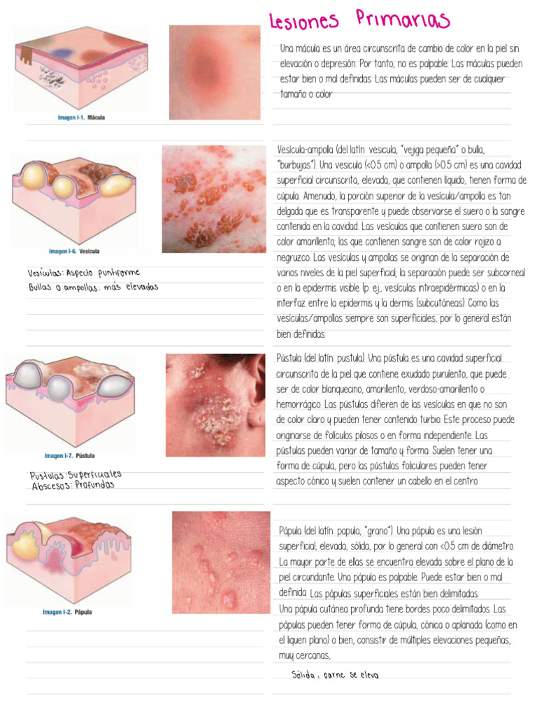 Lesiones Primarias Y Secundarias de La Piel | PDF | Piel | Condiciones cutáneas