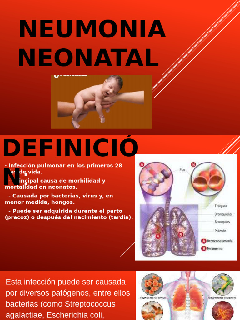 NEUMONIA NEONATAL Exposicion-1 | PDF | Neumonía | Enfermedades y trastornos