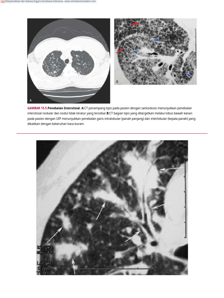 Fundamental Radiology - Compressed Pages 2.en - Id | PDF