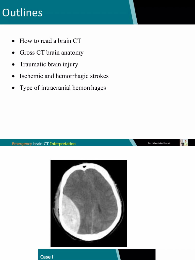 Emergency Brain CT | PDF
