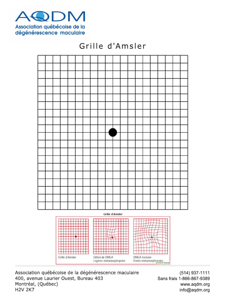 Test Amsler | PDF