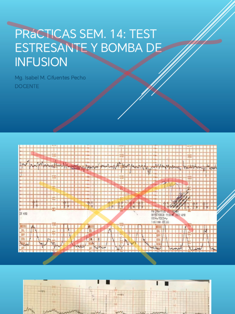 Practicas Sem 14 CST | PDF
