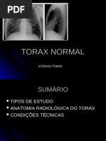 Aula - Protocolo - TC de Tórax | PDF | Átrio (coração) | Pulmão