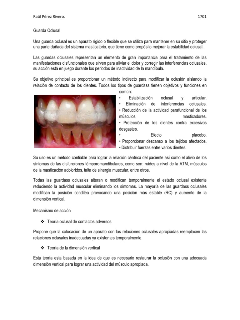 Tipos de Guardas Oclusales y Usos | PDF | Diente humano | Odontología