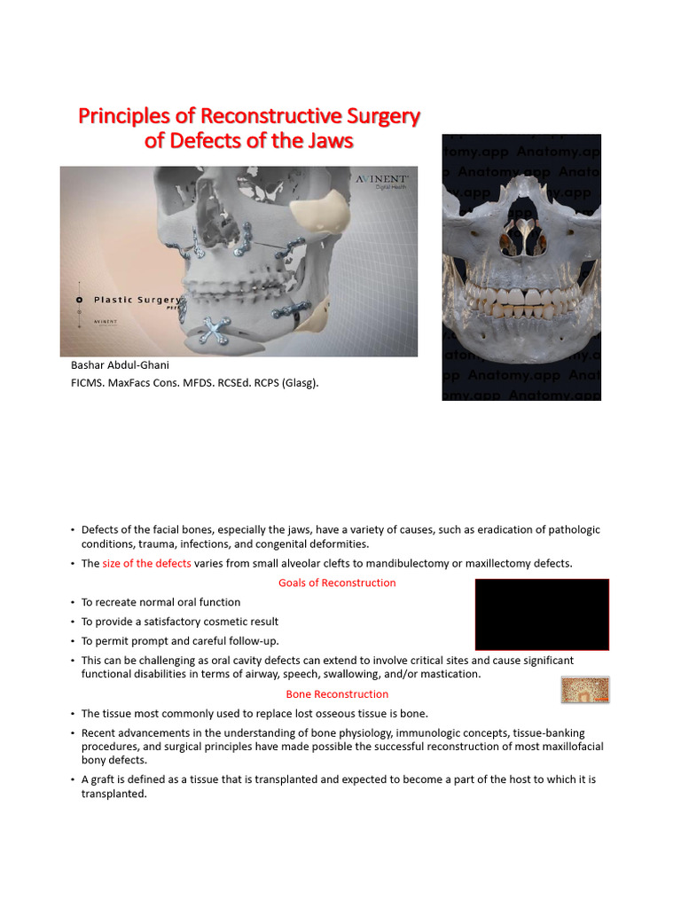 Principles of Reconstructive Surgery 2025 - Converted 2 | PDF | Bone ...