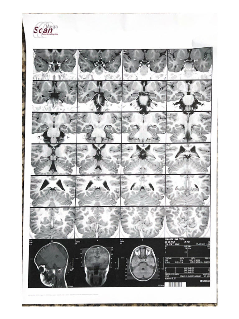 Isaias de Lima Costa 3 | PDF