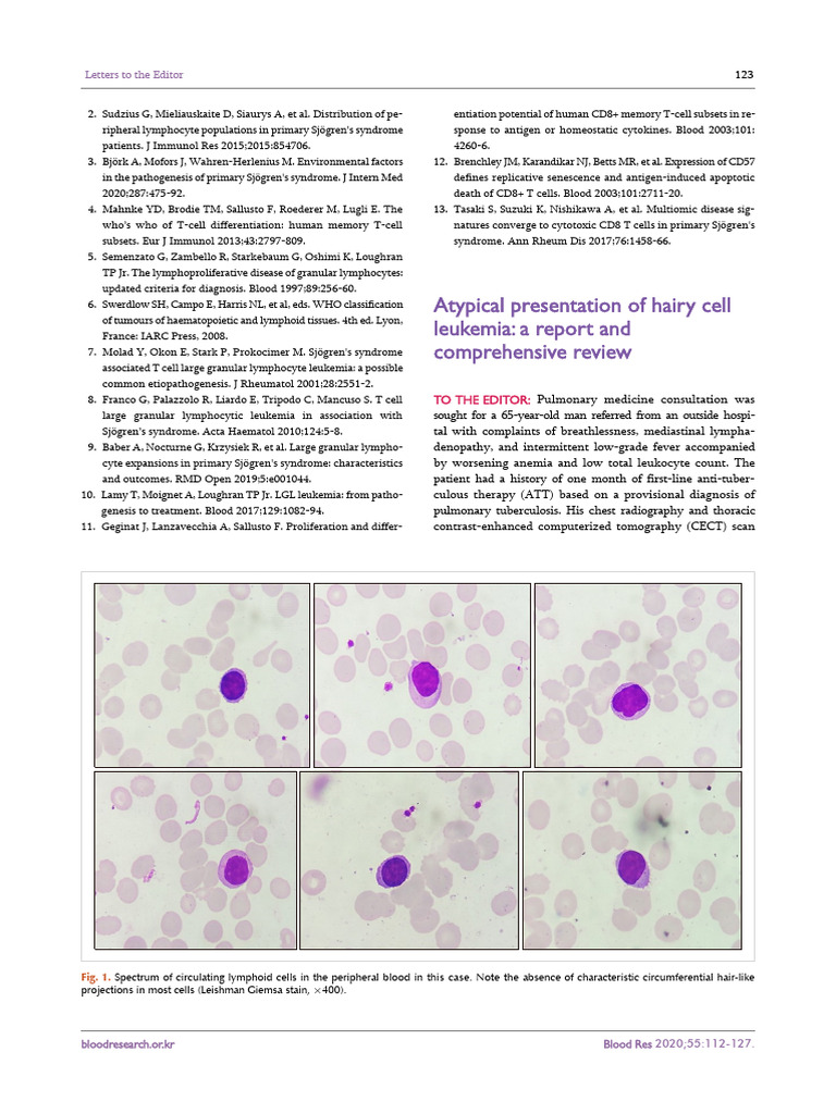 2020, Hairy Cell Leukemia a Report and Comprehensive Review | PDF ...