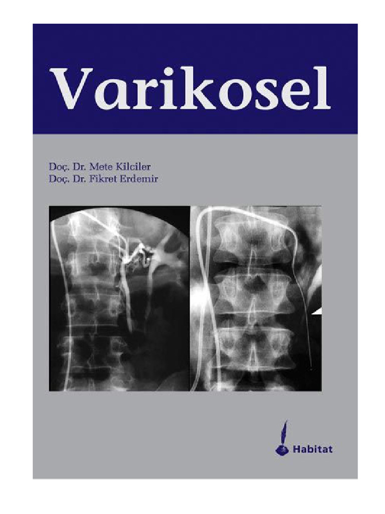 Varikosel | PDF