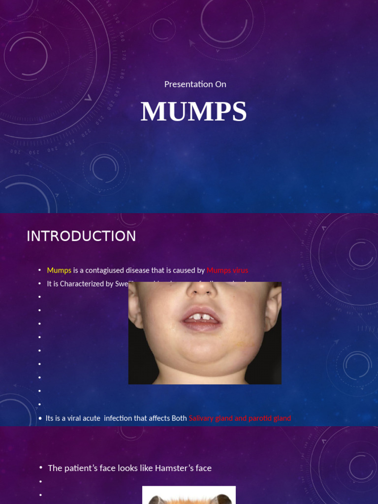 Prsnt Mumps | PDF