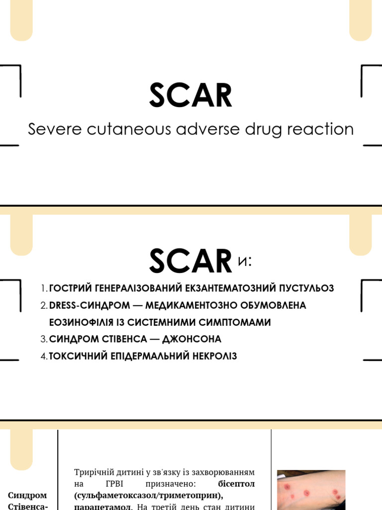 Scar | PDF
