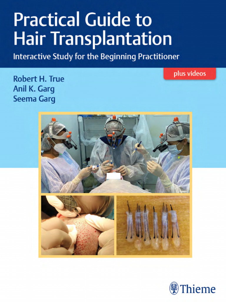 ESP Practical Guide to Hair Transplantation Prt 1 | PDF | Pelo | Cirugía