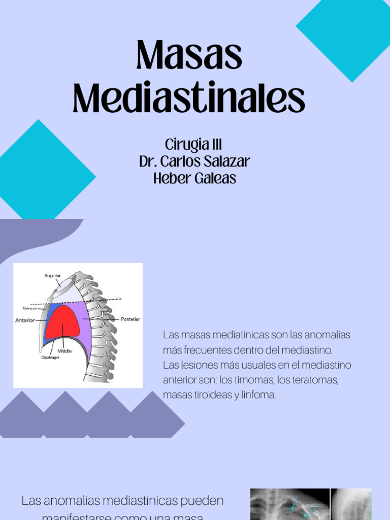 Masas Mediastinales | PDF | Cáncer | Neoplasias