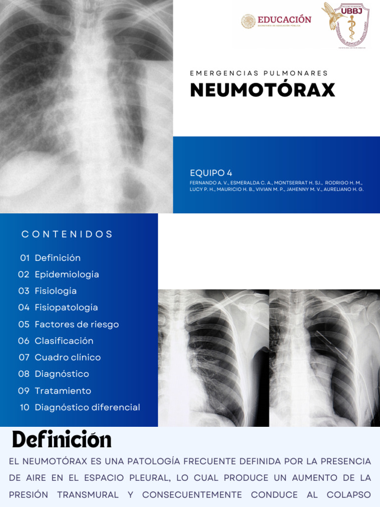 Definición y manejo del neumotórax | PDF | Enfermedades y trastornos ...